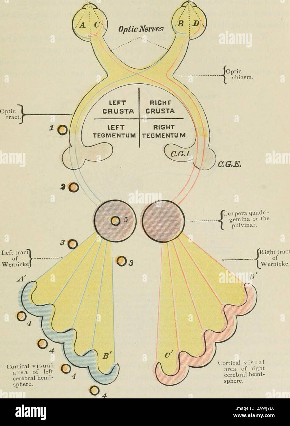 Hemianopsia hi-res stock photography and images - Alamy
