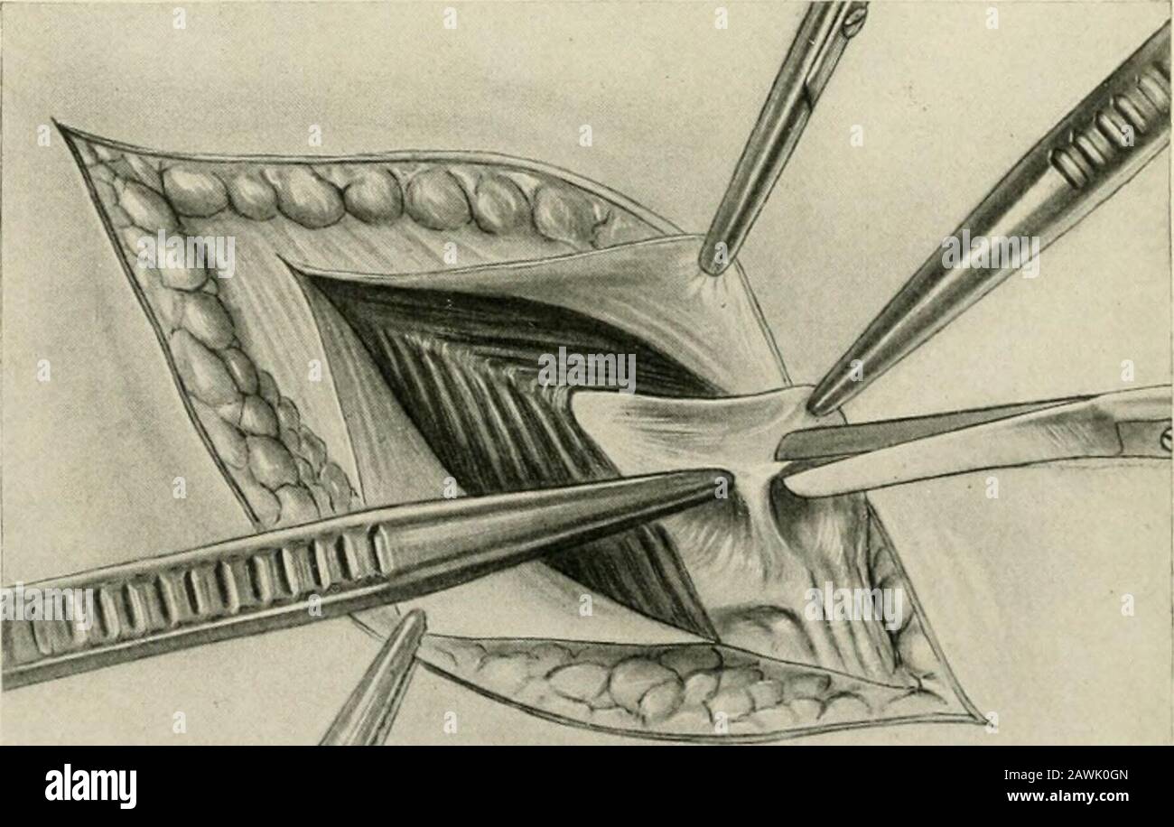 Cremasteric hi-res stock photography and images - Alamy