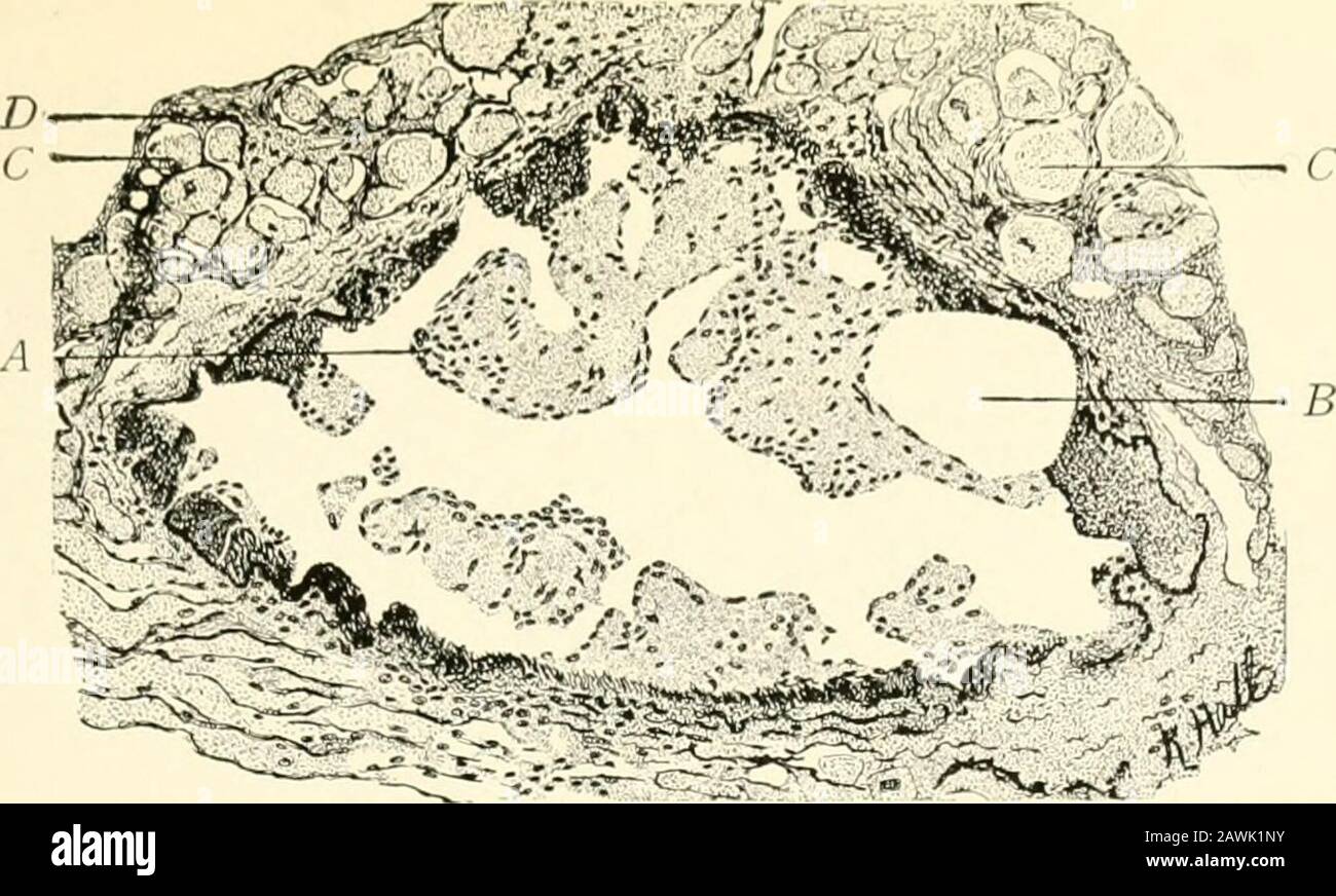 Hypochondrium hi-res stock photography and images - Alamy