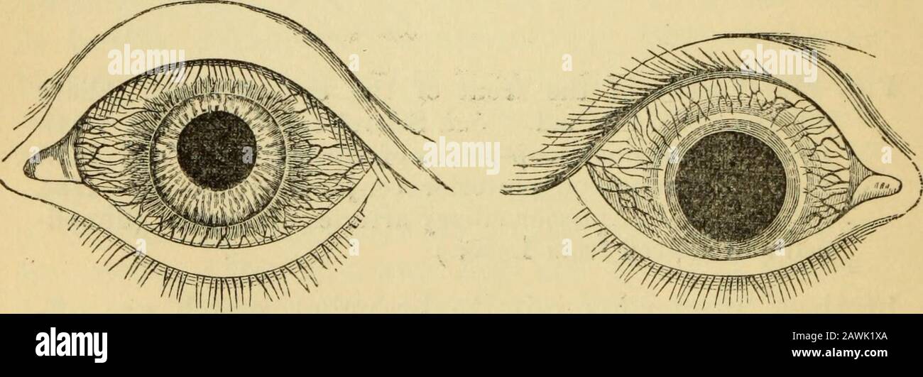 Anterior ciliary arteries hi-res stock photography and images - Alamy