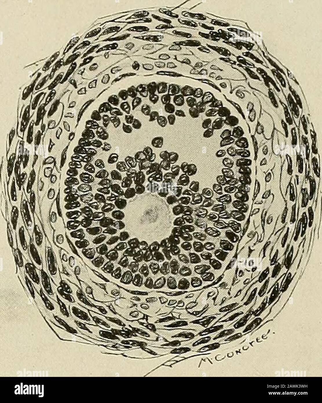 Primordial follicle hi-res stock photography and images - Alamy