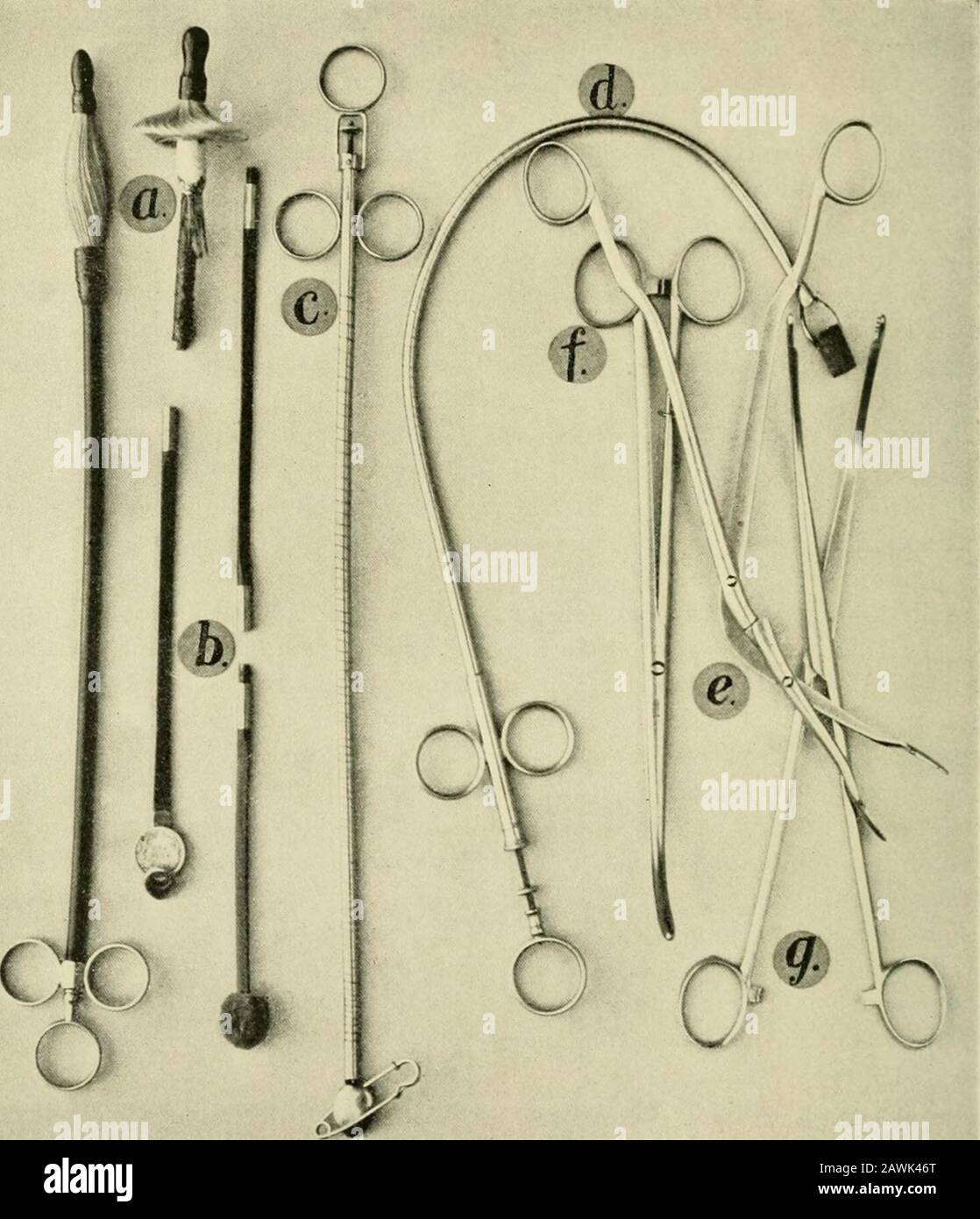 Foreign body in esophagus hi-res stock photography and images - Alamy