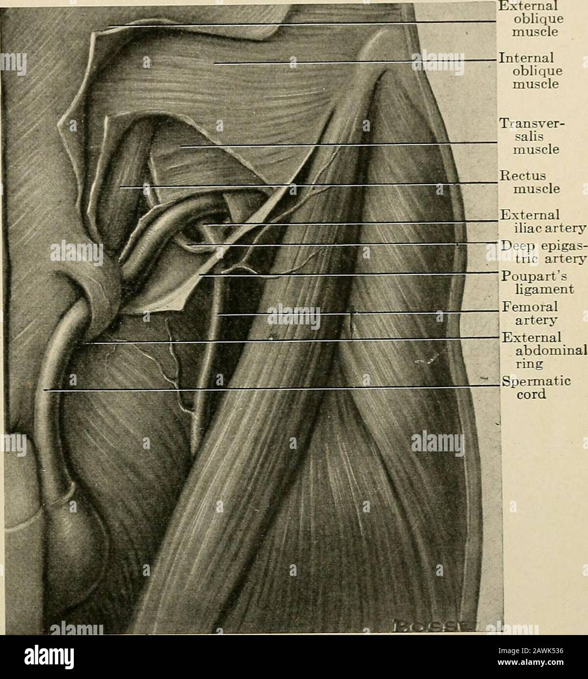 Psoas Abscess Anatomy