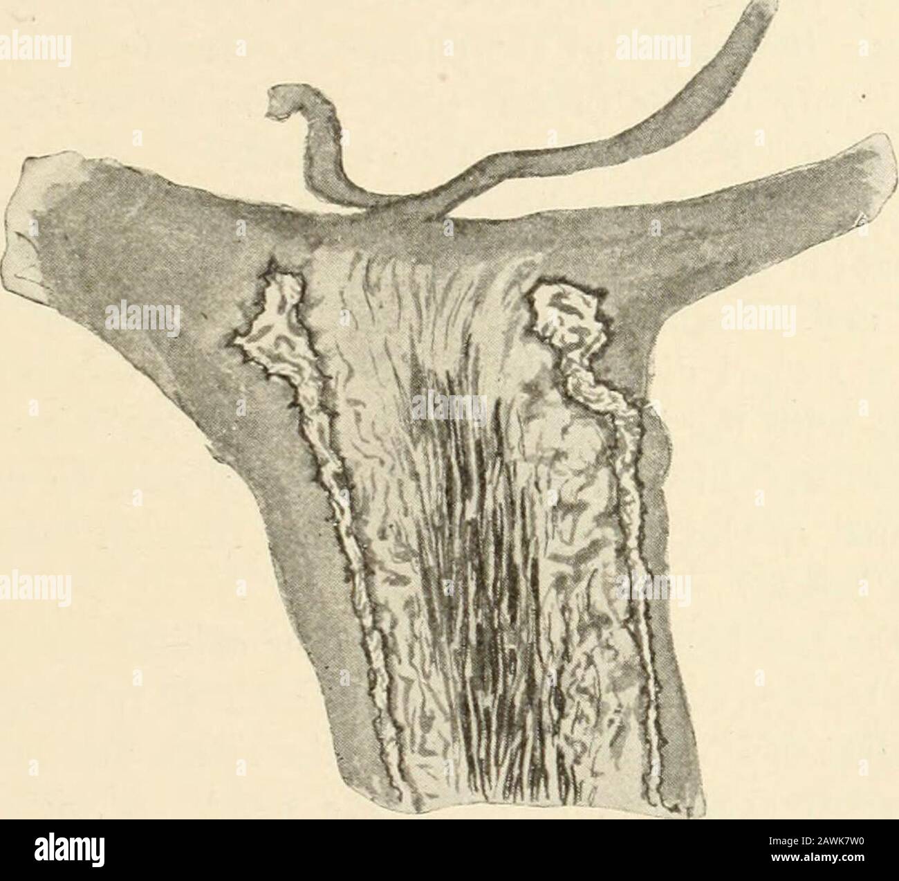 The Journal of nervous and mental disease . globulin ± ; salvarsan—2 ...