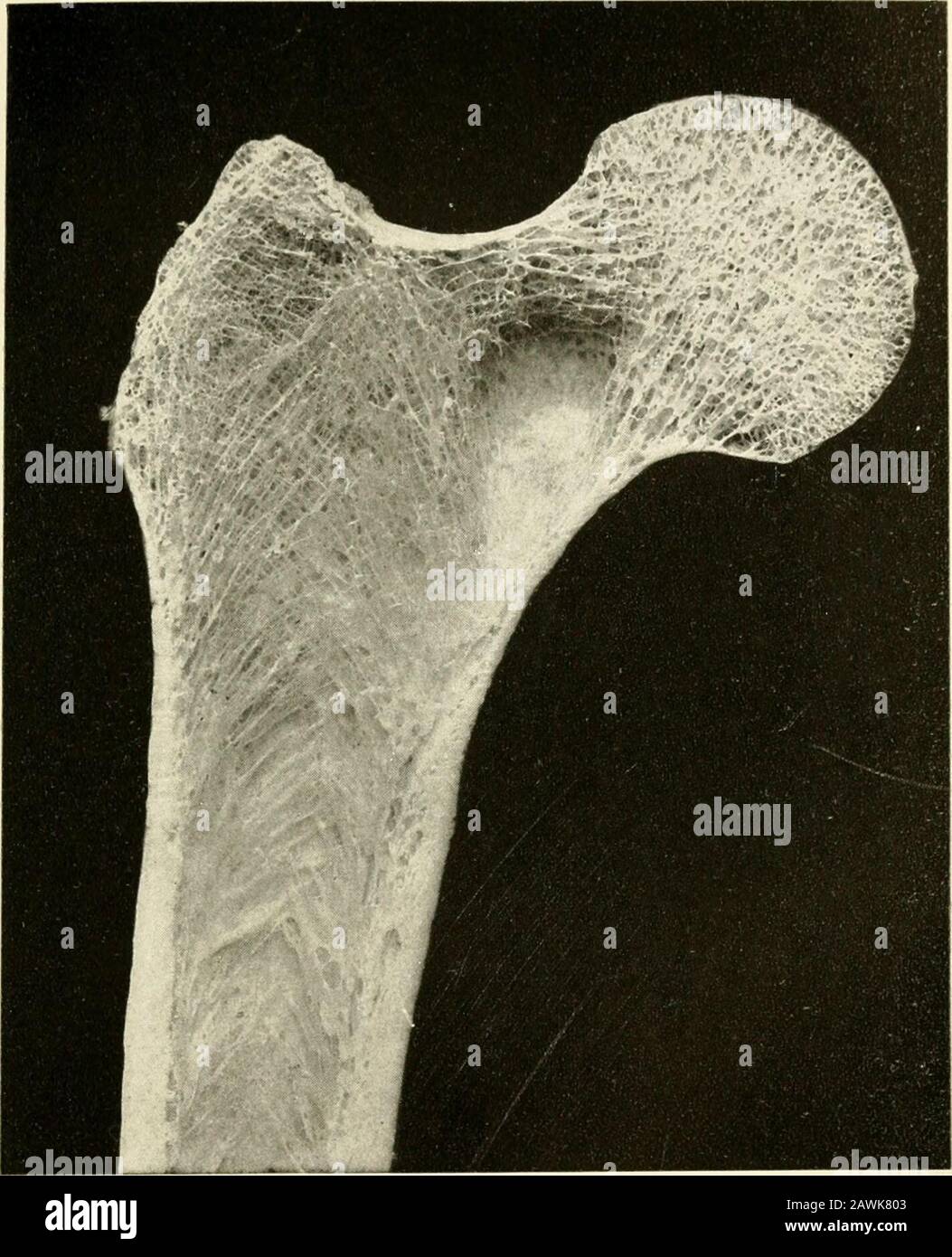 Geriatrics bone hi-res stock photography and images - Alamy