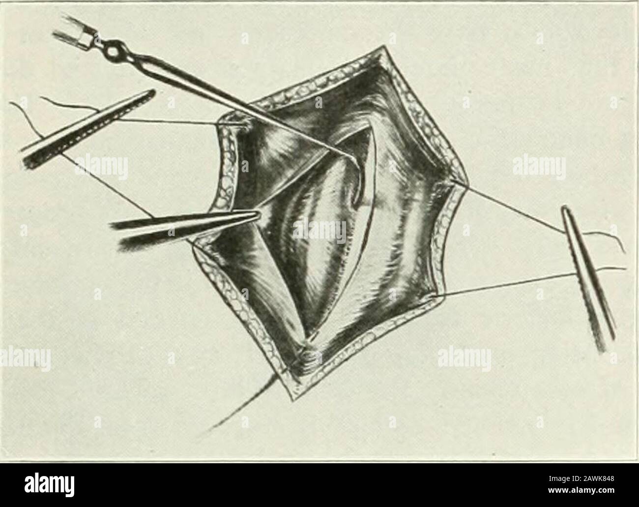 Lac step hi-res stock photography and images - Alamy