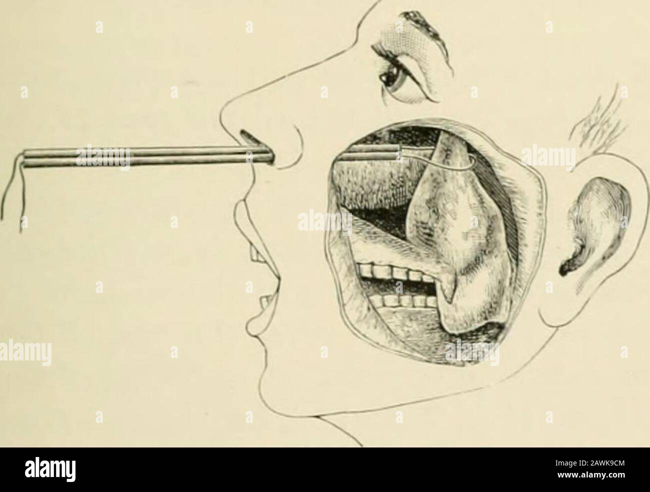Parallel nostril hi-res stock photography and images - Alamy