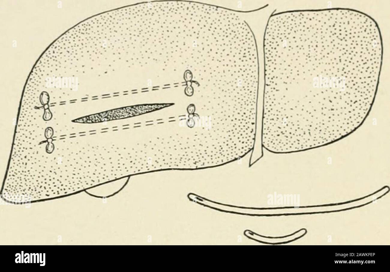 The practice of surgery . sthoracic approach to the liver. much the ...