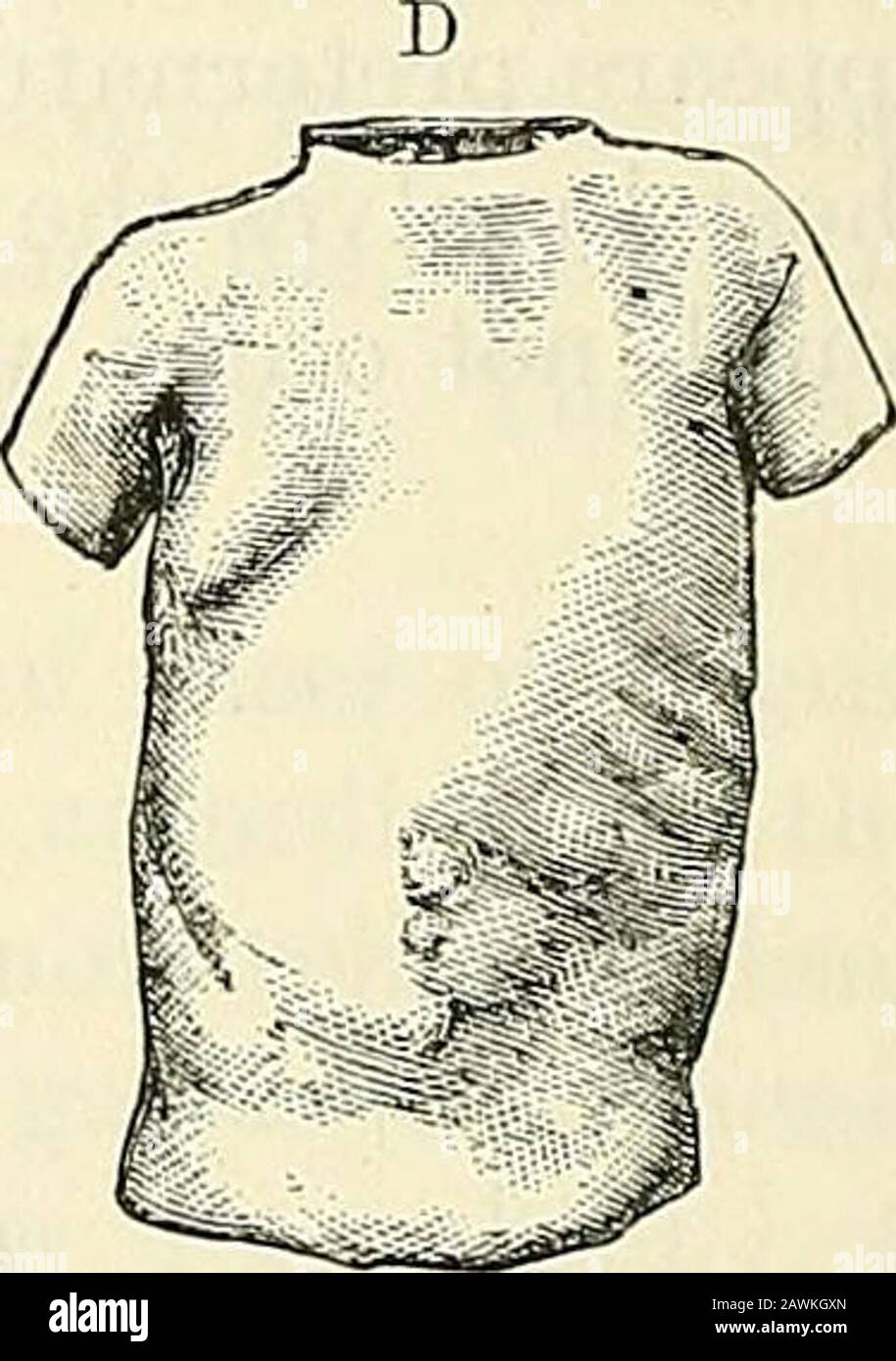 Spine drawing curvature hi-res stock photography and images - Alamy