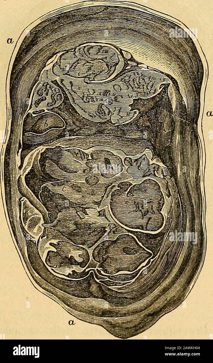 Prozess der diagnose hi-res stock photography and images - Alamy