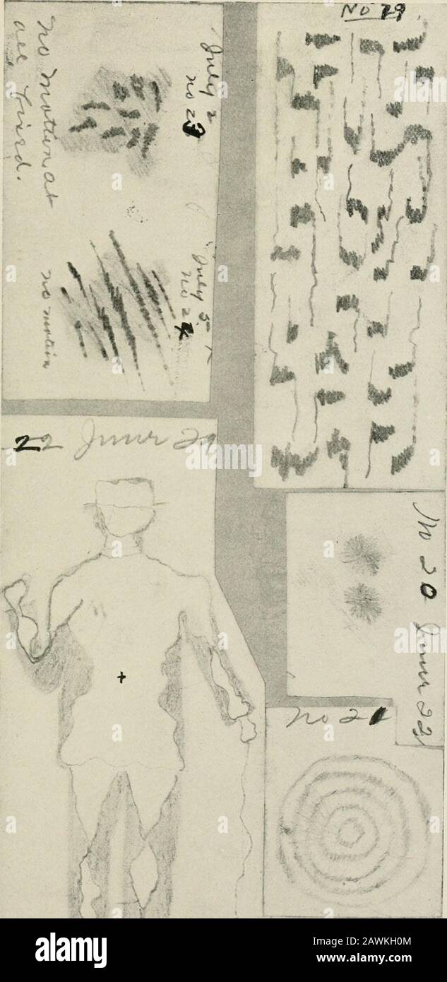 Scotoma hi-res stock photography and images - Alamy