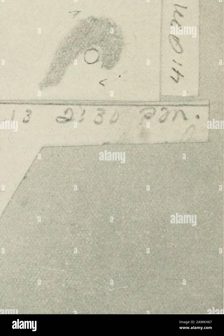 Scotoma hi-res stock photography and images - Alamy