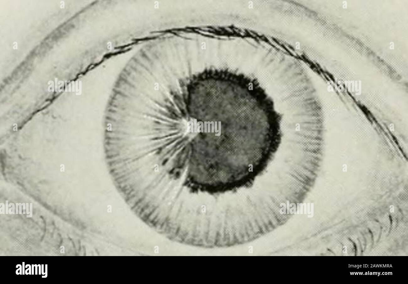 Peduncular tissue hi-res stock photography and images - Alamy