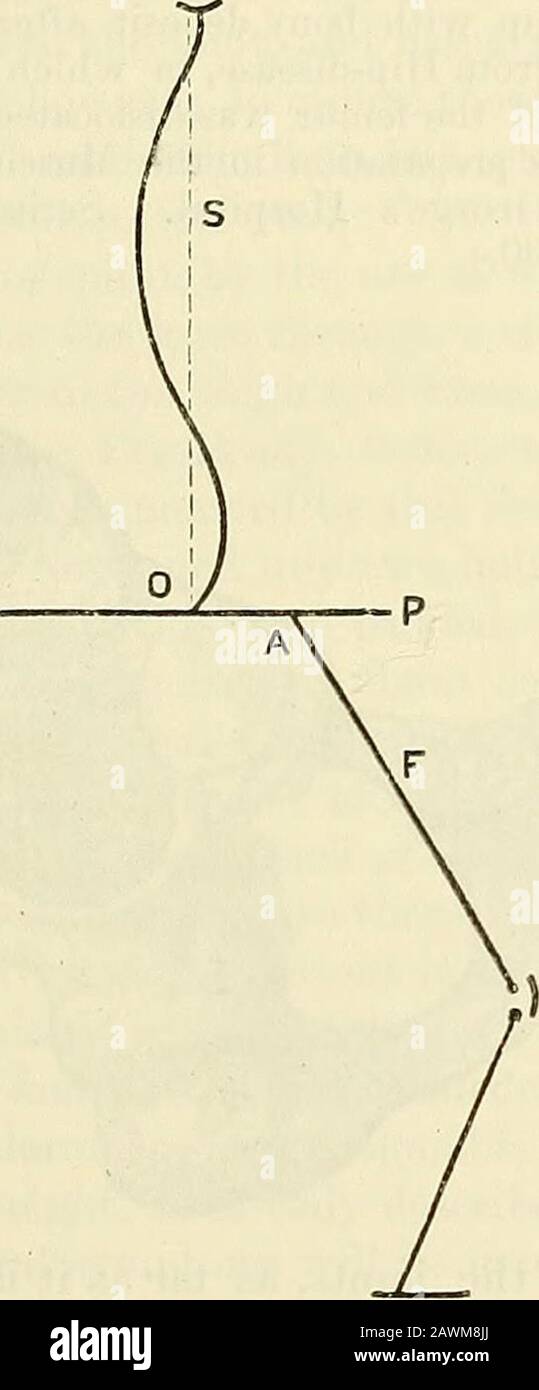 Fixed joint hi-res stock photography and images - Alamy