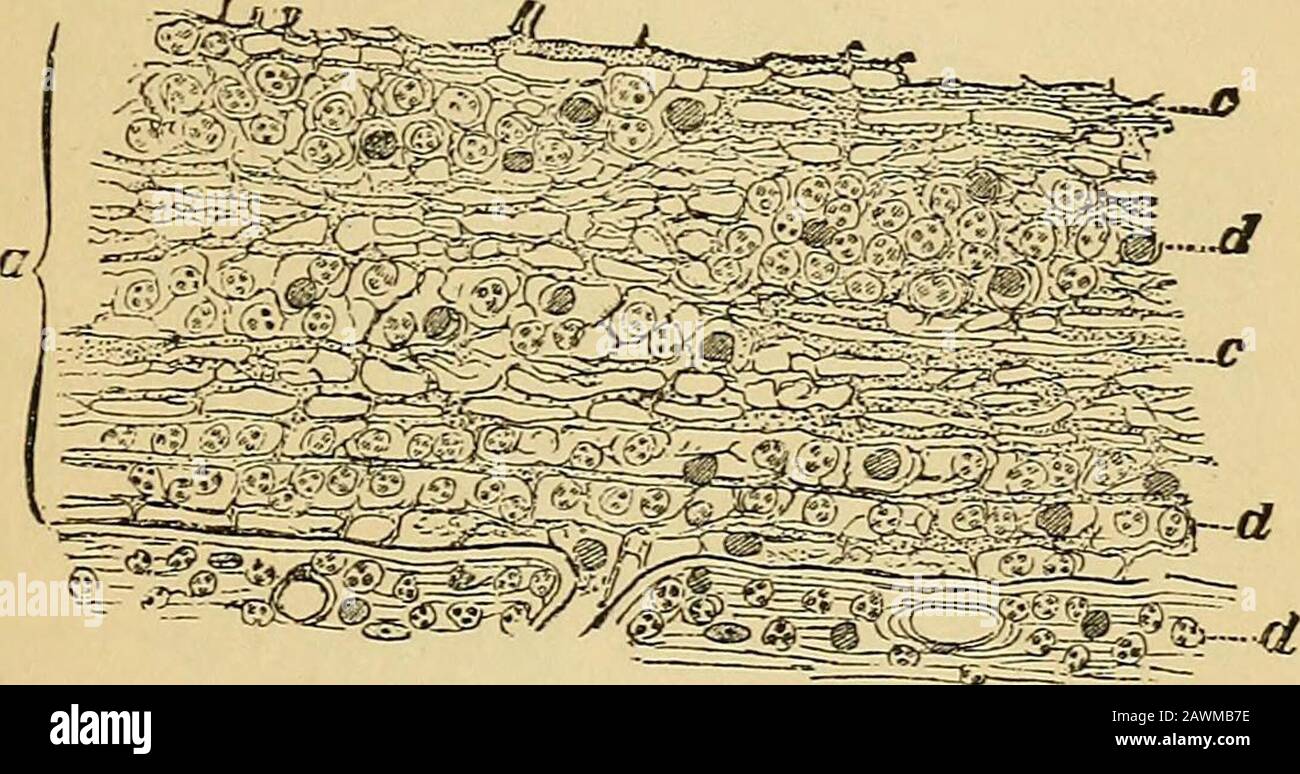 Diptheria, its nature and treatment . coagulations is apeculiar feature ...