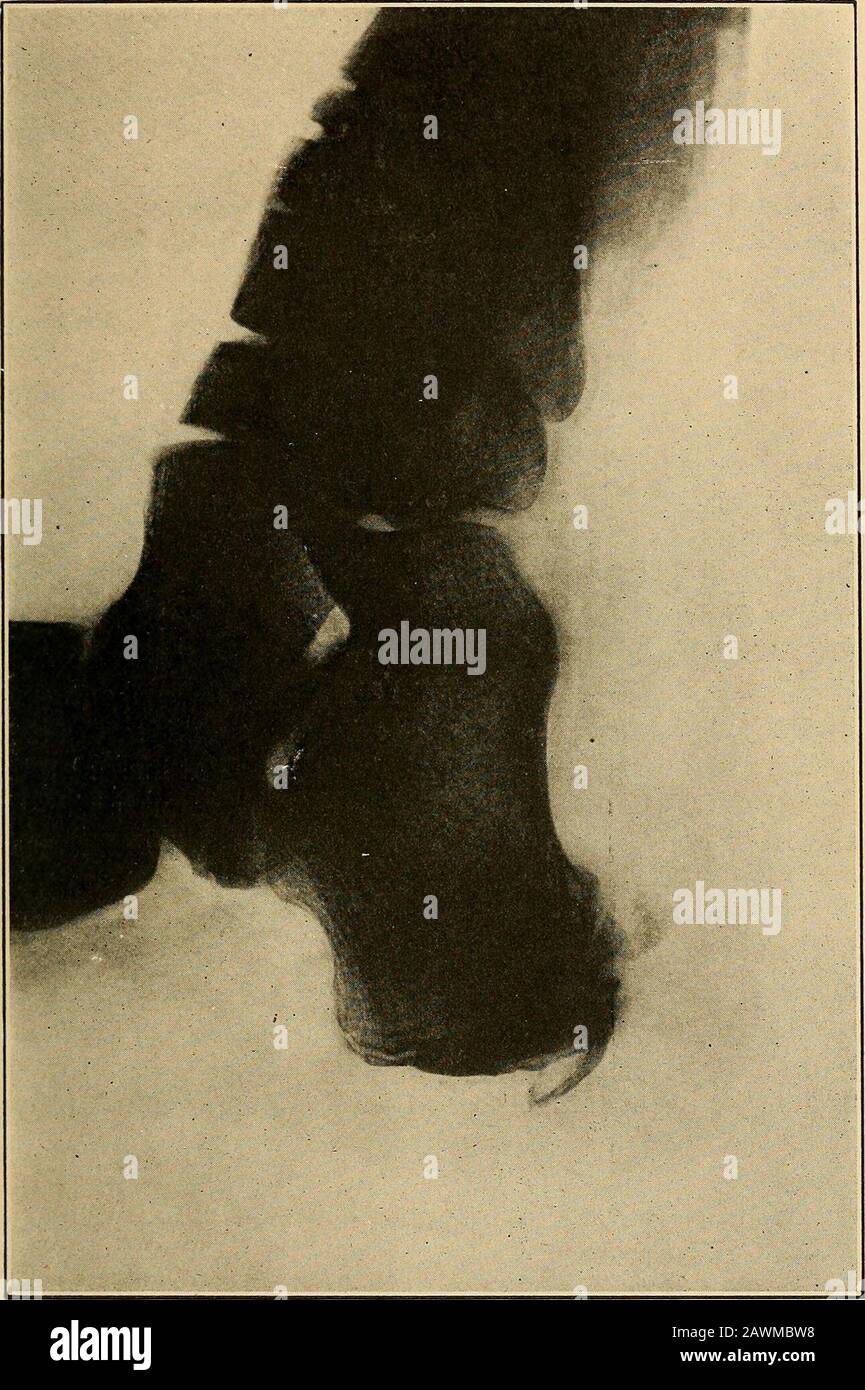 Practical podiatry : . here is exten-sive splintering of the bone ...