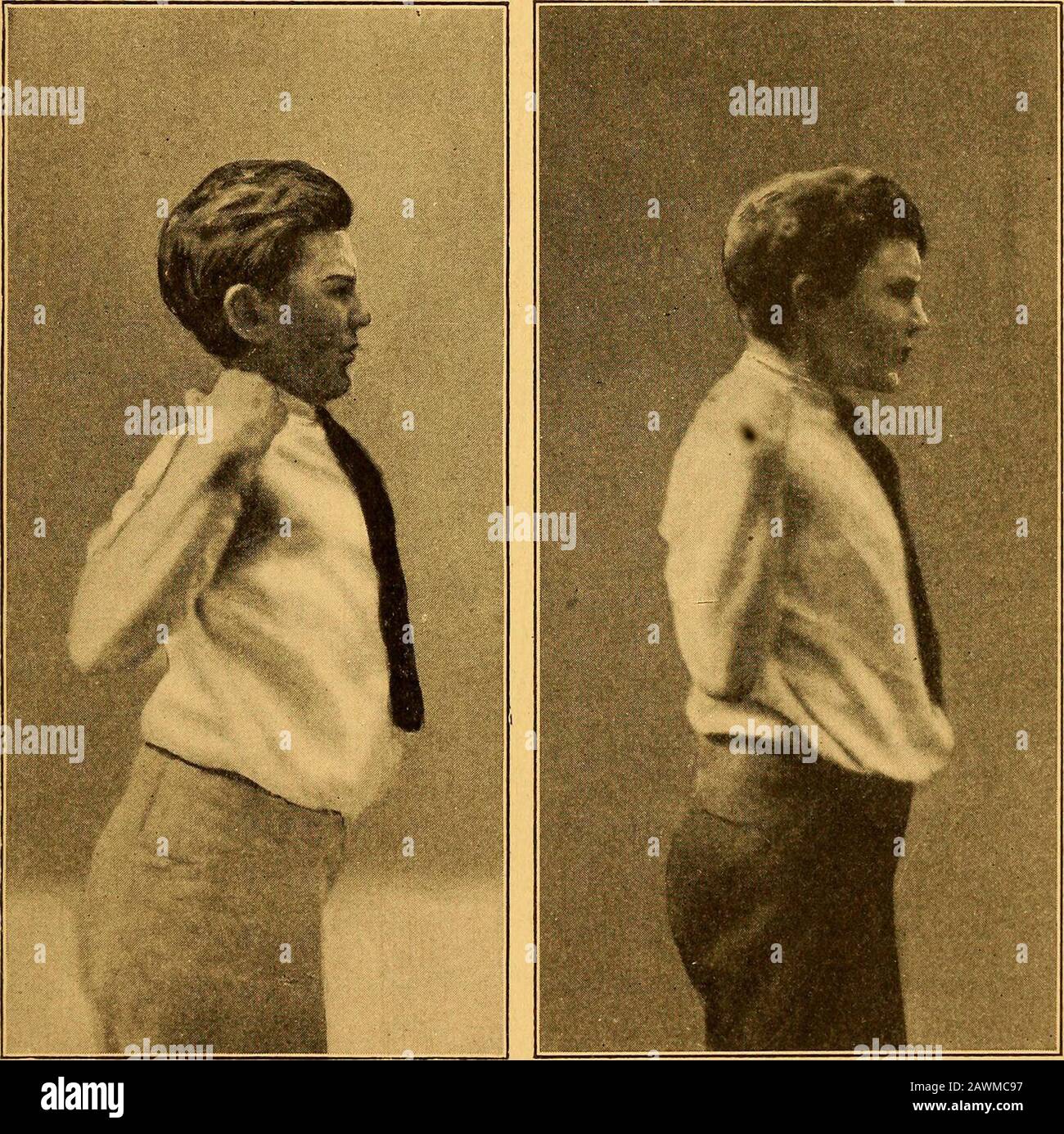 Shoulder blade exercise hi-res stock photography and images - Alamy