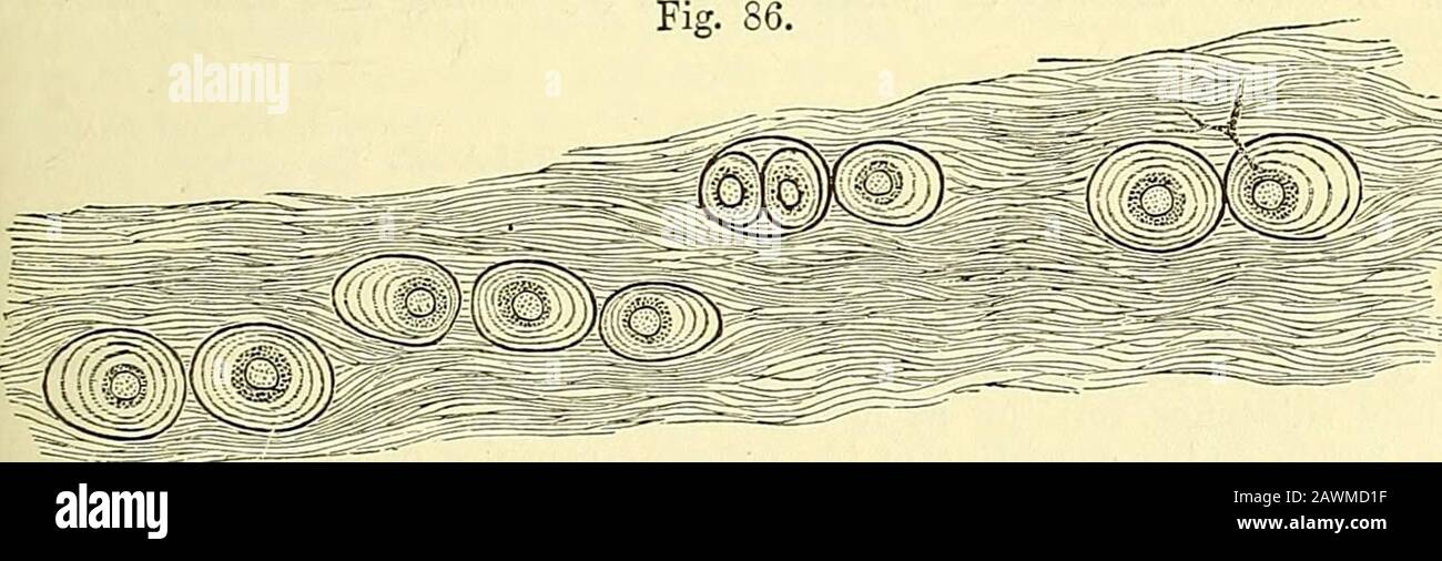 Fibrocartilage Drawing