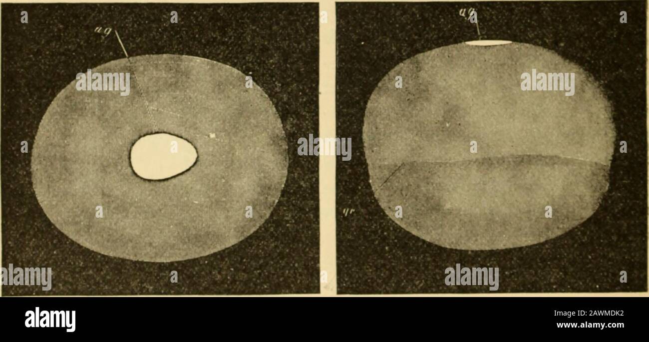A system of obstetrics . Diagrammatic Transverse Section through a ...