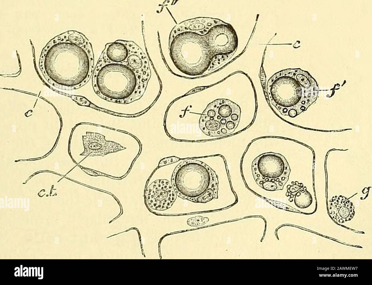 Granular cell hi-res stock photography and images - Alamy