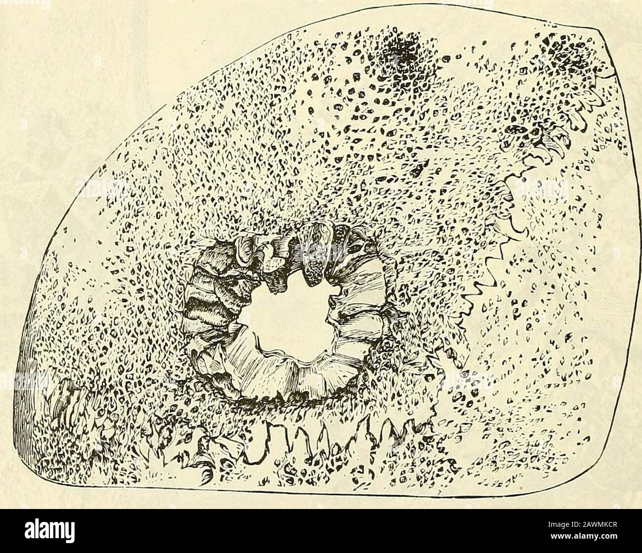 Whole clavicle bone hi-res stock photography and images - Alamy