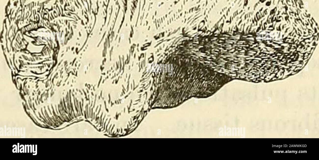 Scrofulous hi-res stock photography and images - Alamy