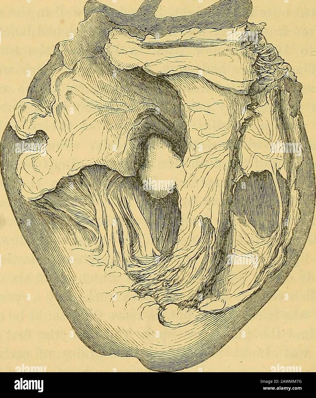 Diseases of the ovaries : their diagnosis and treatment . therectum ...