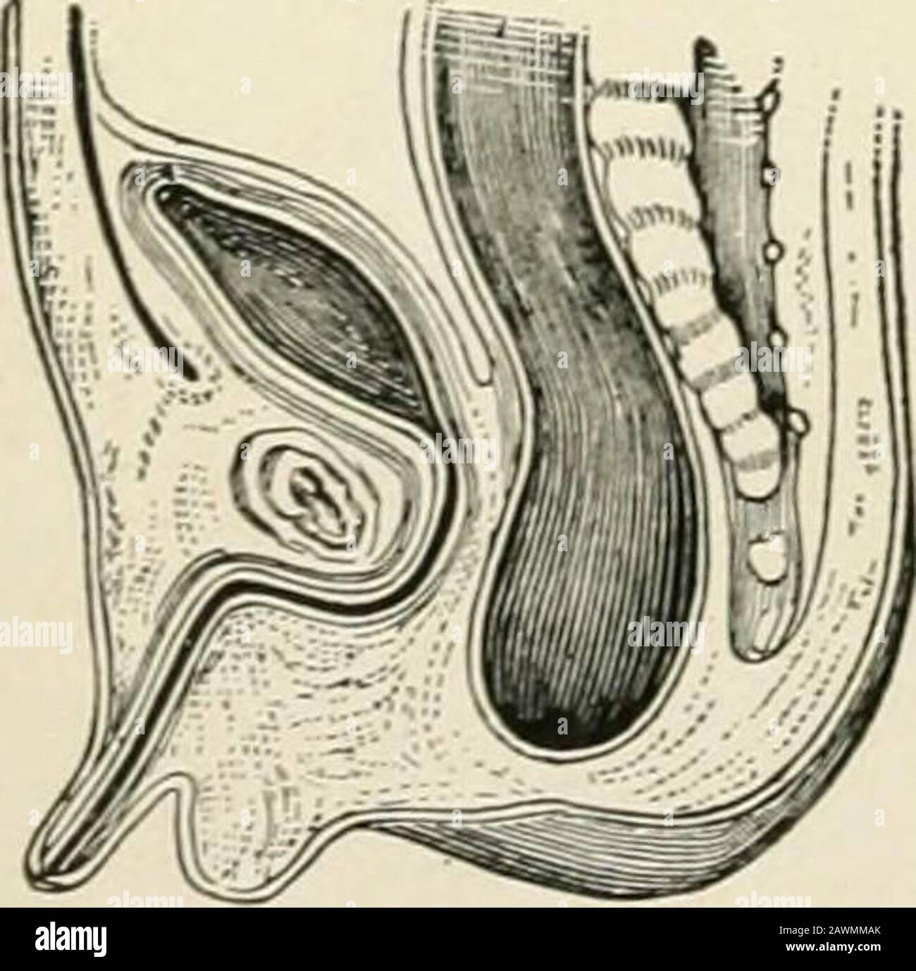 Silver nitrate process hi-res stock photography and images - Alamy