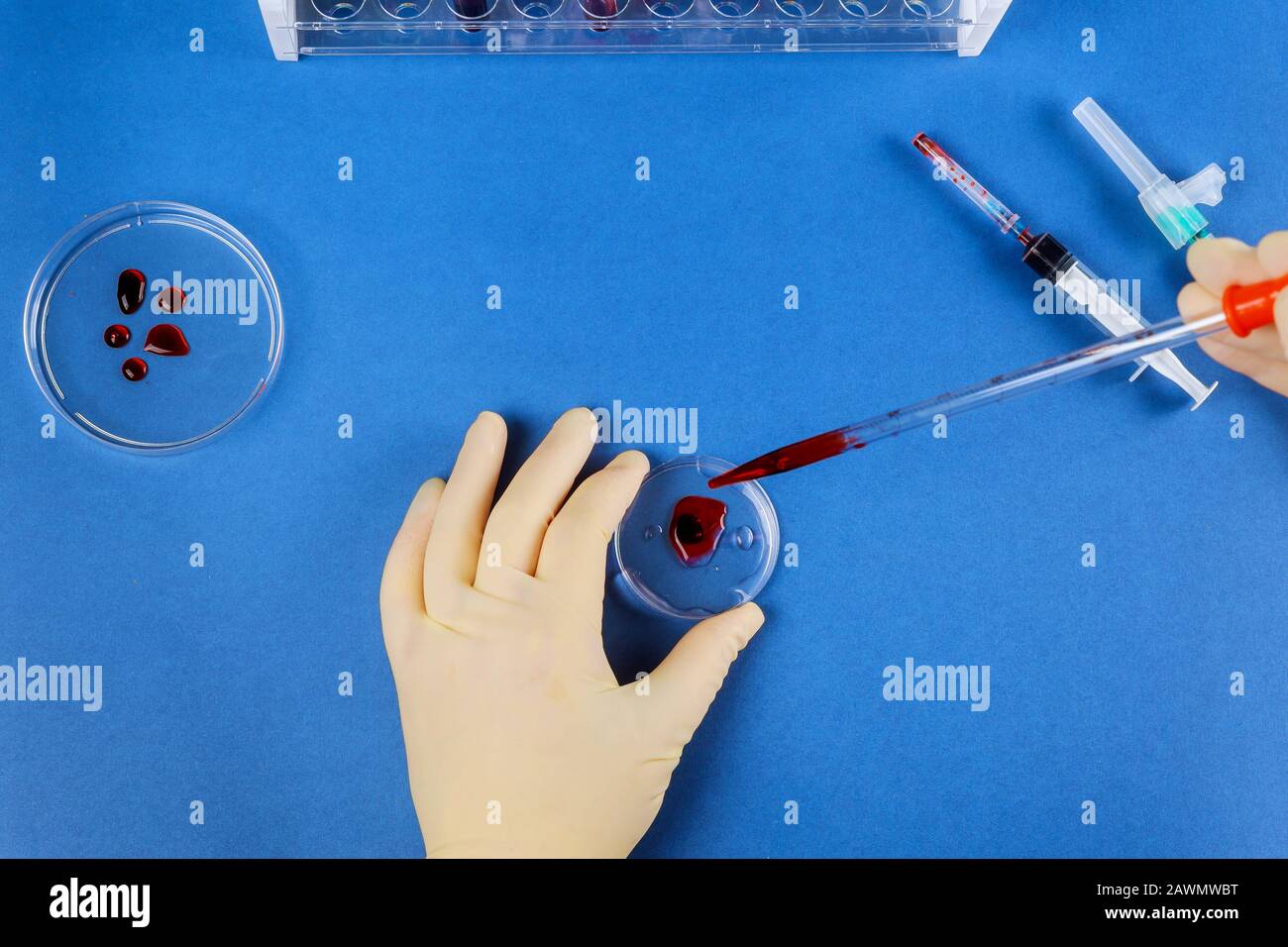 Blood test in the syringe on glove in medical laboratory Stock Photo ...