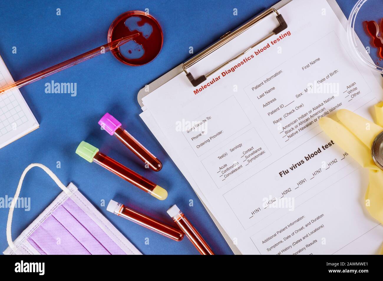 Blood sample with flu virus check-up analysis in laboratory with health ...