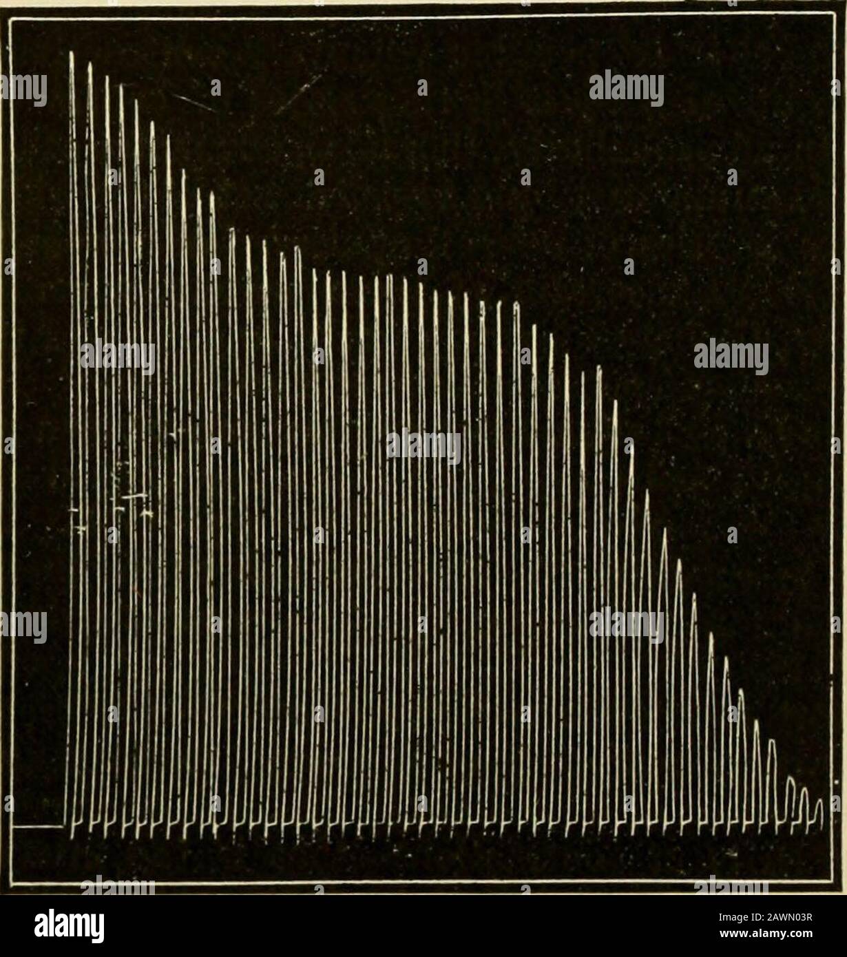 Finger flexors hi-res stock photography and images - Alamy