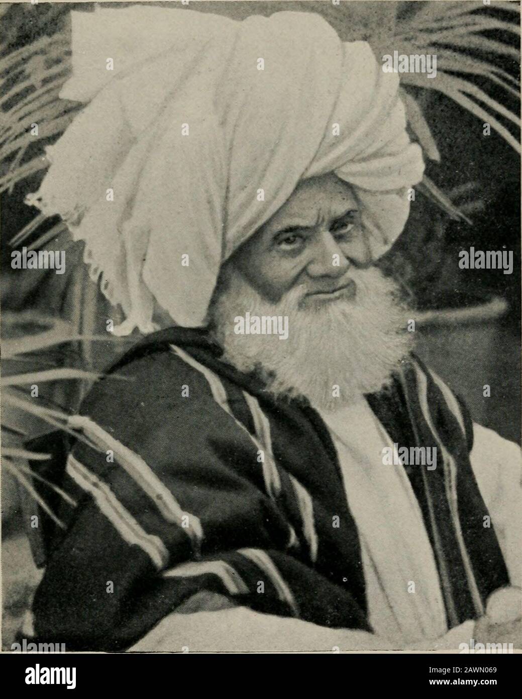 Smallpox indian hi-res stock photography and images - Alamy