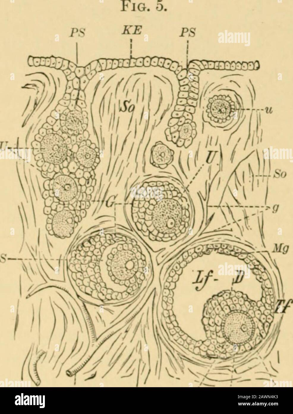 Stroma Ovary