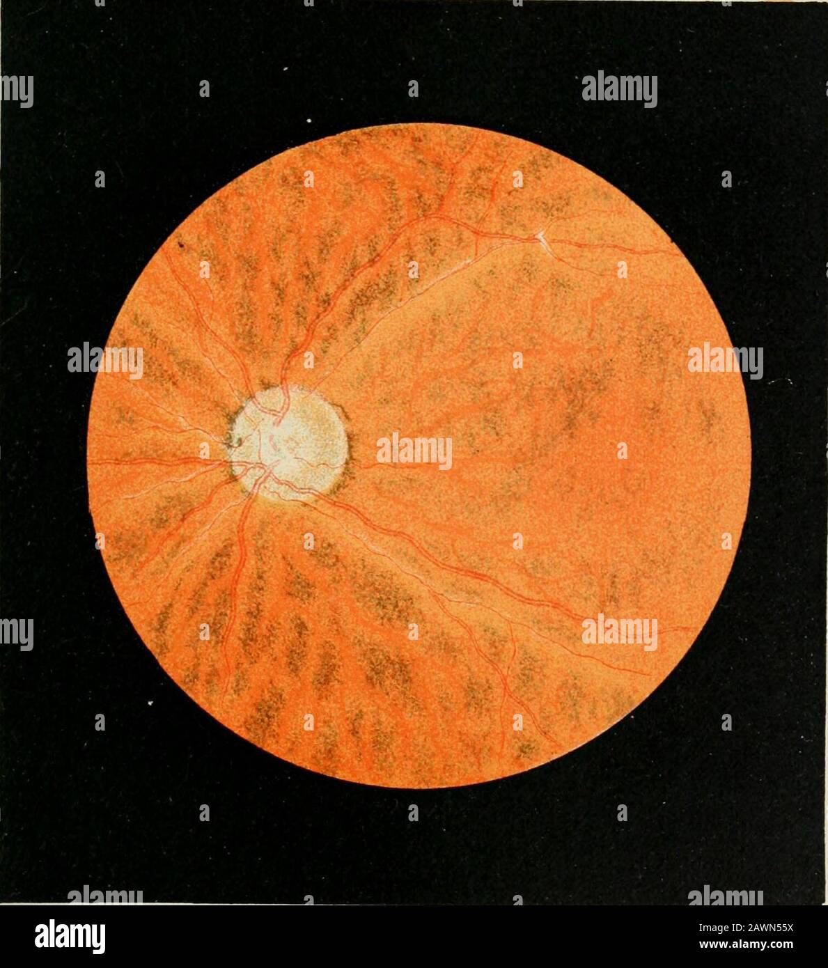 Dilated fundus examination hi-res stock photography and images - Alamy