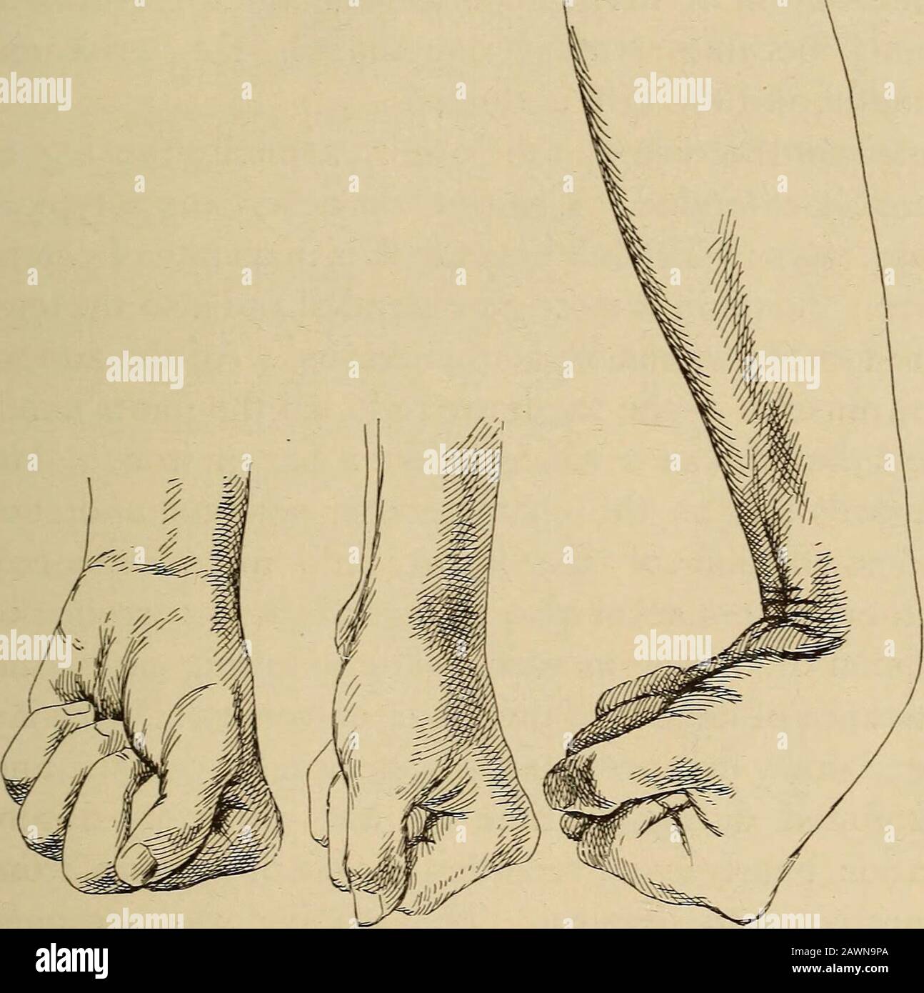 Upper extremity muscles hi-res stock photography and images - Alamy