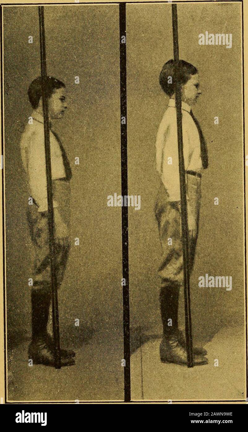 Badposture hi-res stock photography and images - Alamy