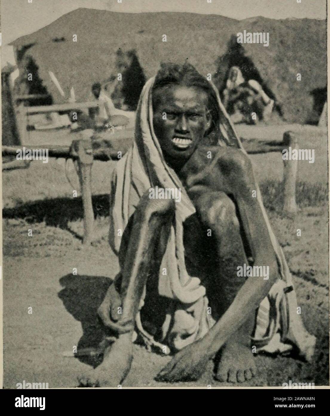 Indian lepers hi-res stock photography and images - Alamy