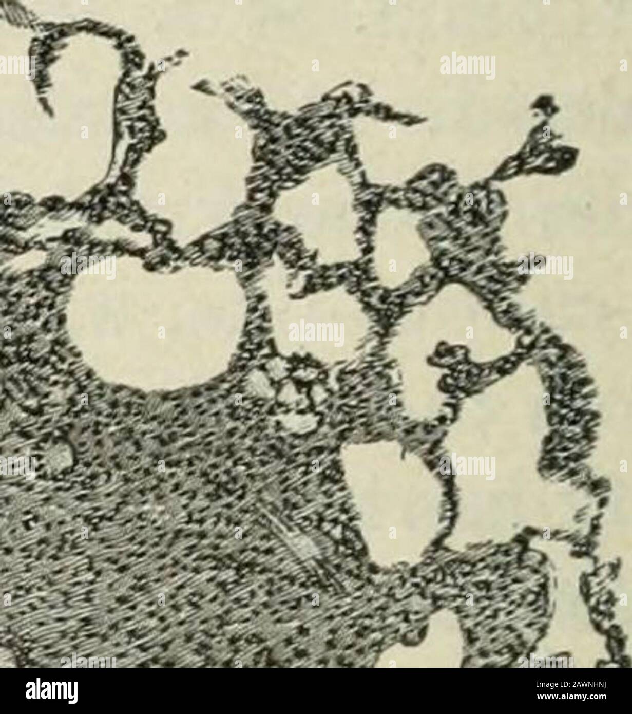 Handbook of meat inspection . f>>i^ Miliary tubercle with numerous ...