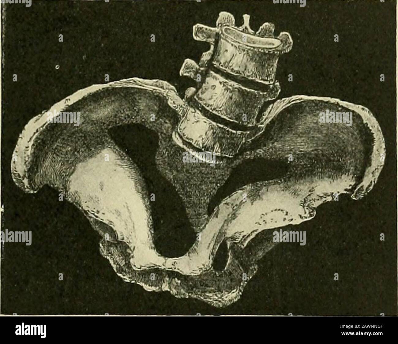 Pelvis 1 hi-res stock photography and images - Alamy