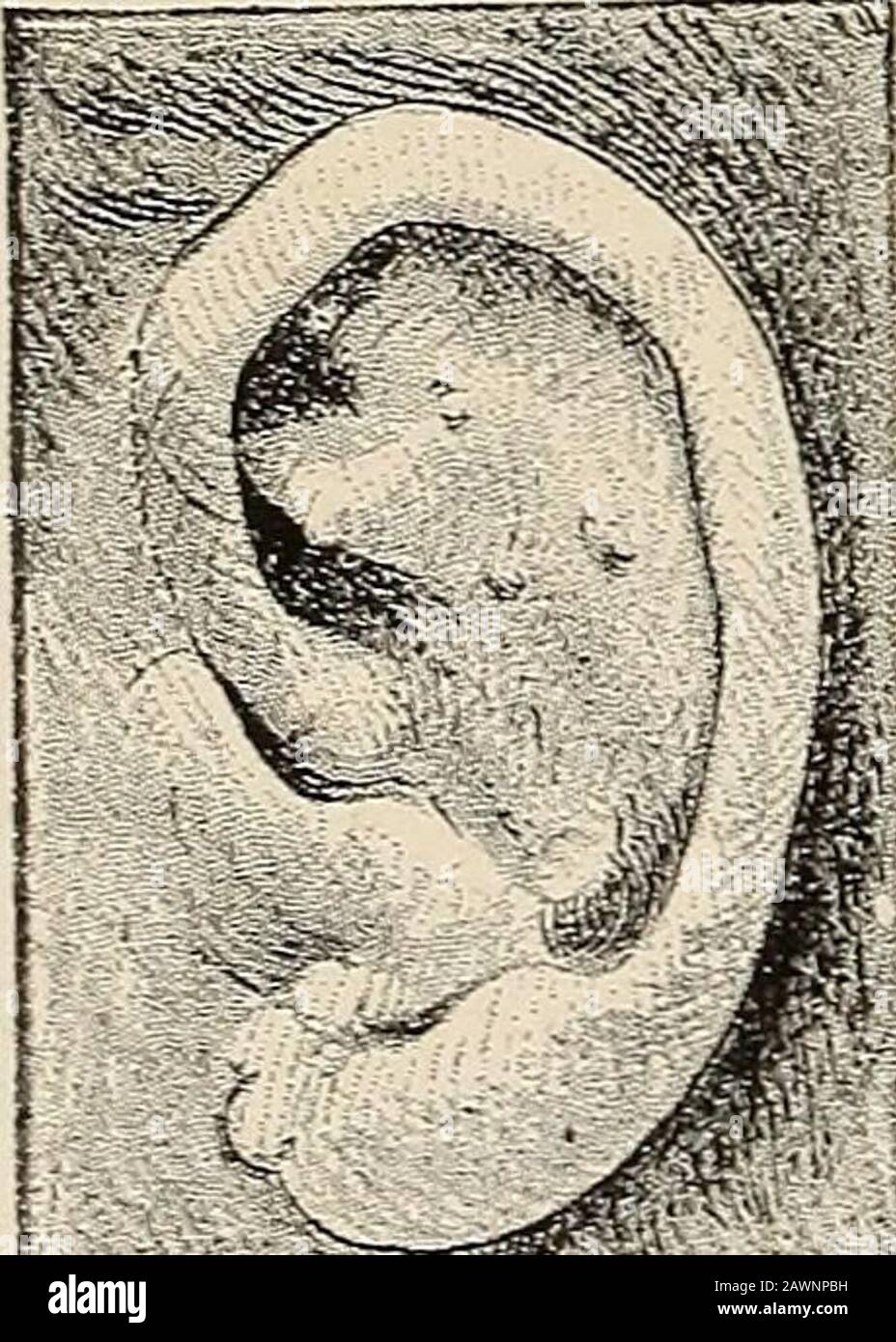 Nervous and mental diseases . Fie. 296.—Triplication of crura furcata ...