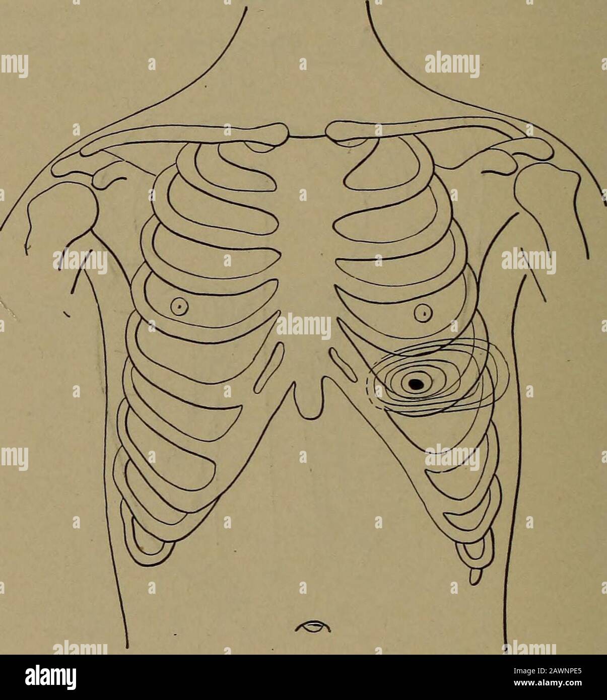 C m arrow hi-res stock photography and images - Alamy