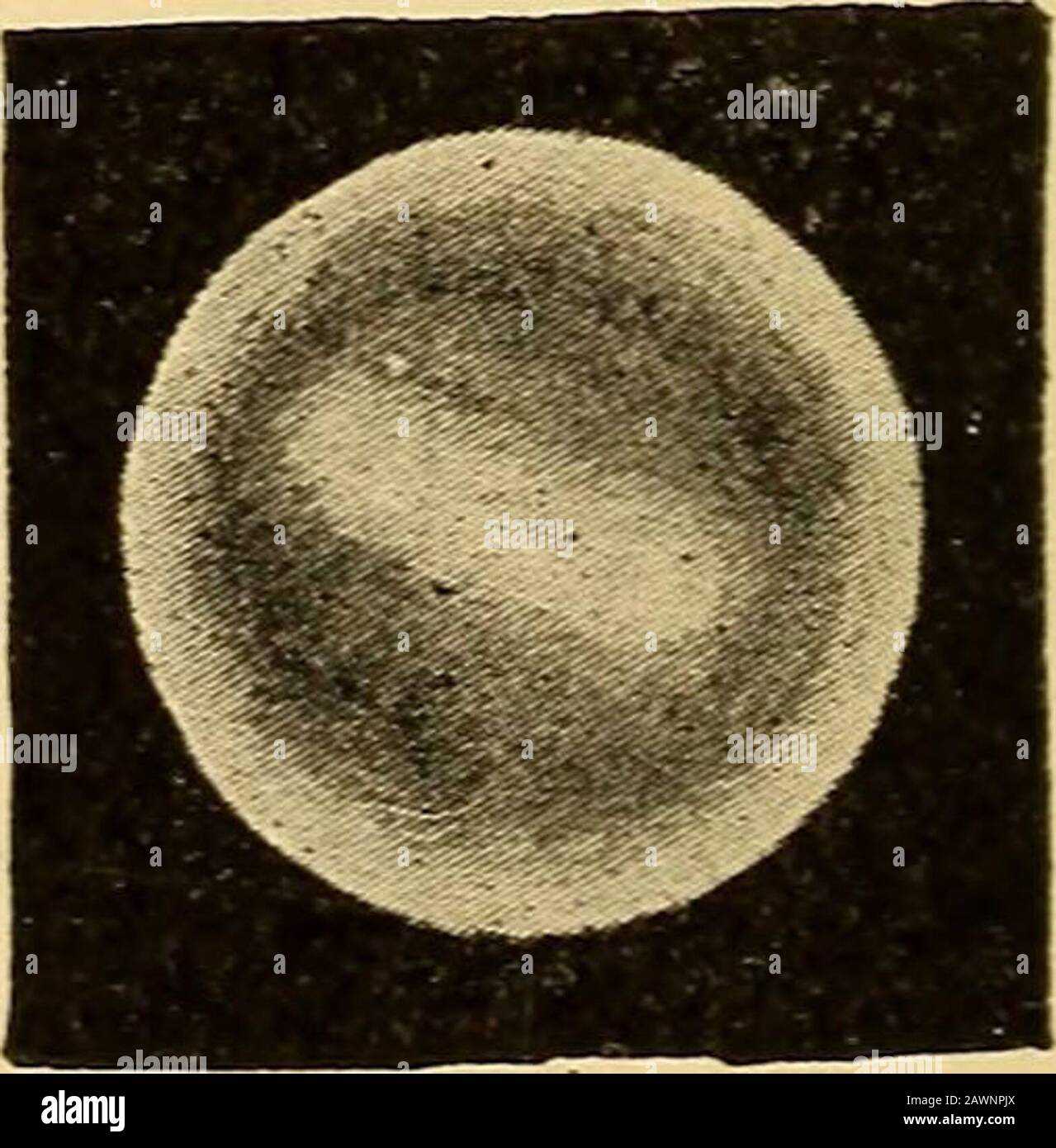 Skiascopy and its practical application to the study of refraction ...