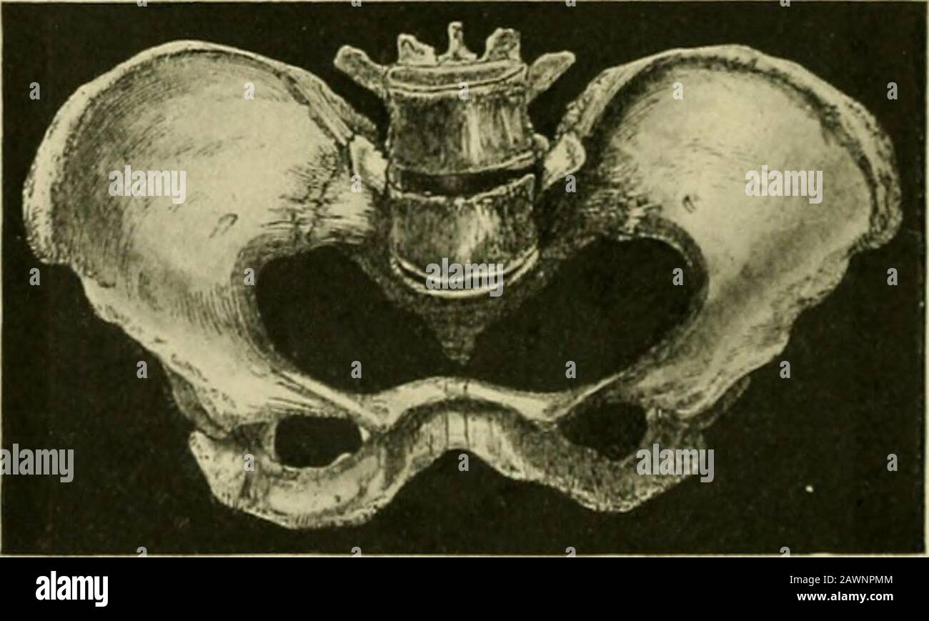 Operative midwifery : a guide to the difficulties and complications of ...