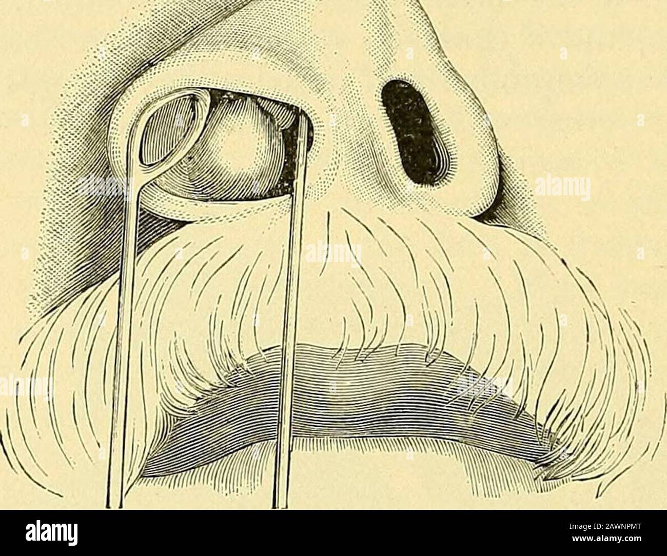 Cervical lining hi-res stock photography and images - Alamy