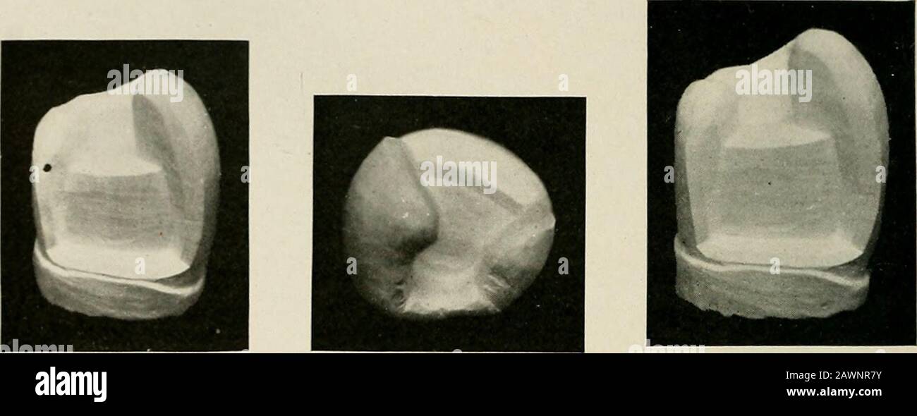 Technic and scope of cast gold and porcelain inlays; with a chapter on ...