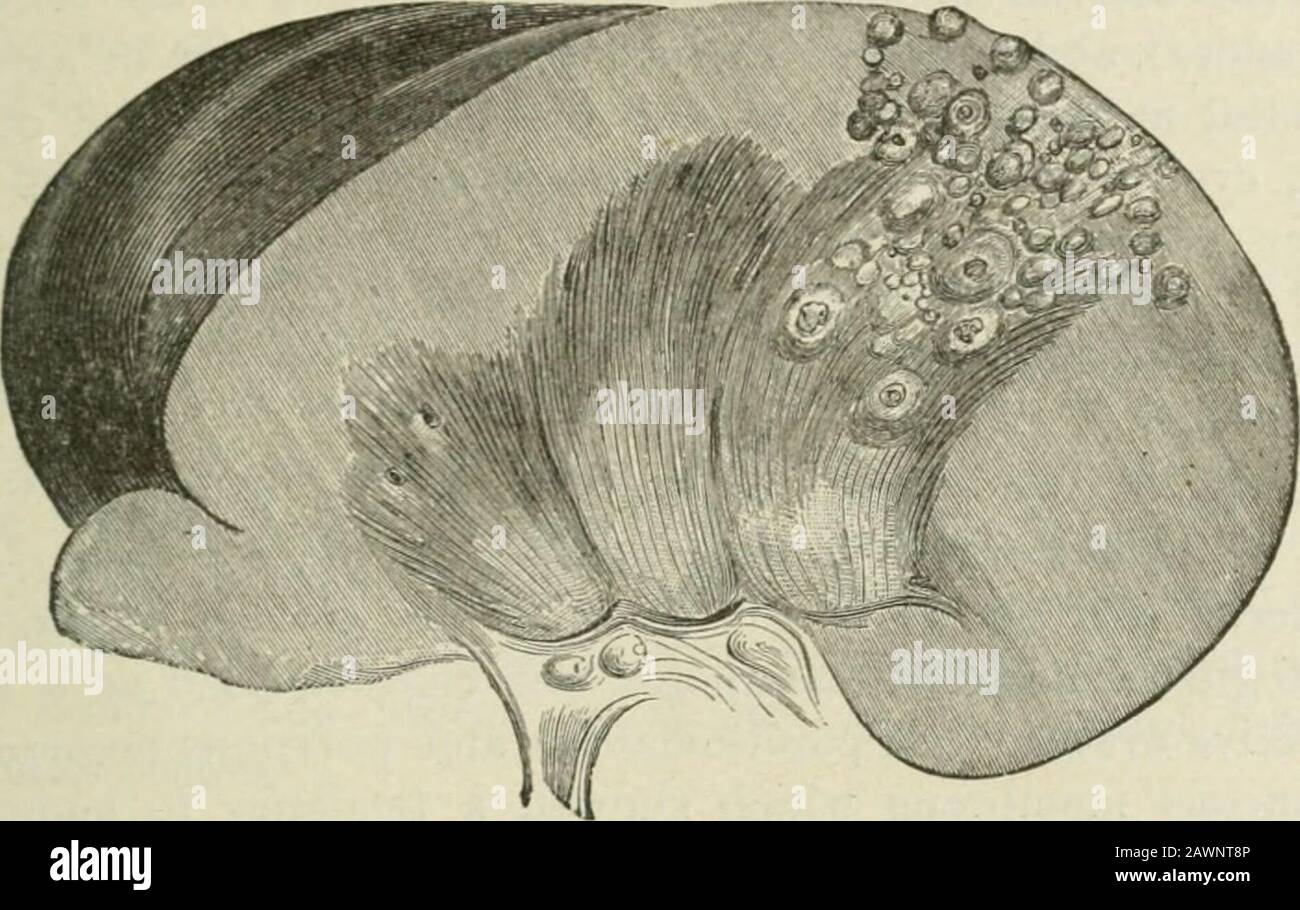 Handbook of meat inspection . Bovine kidney with tuberculosis in ...