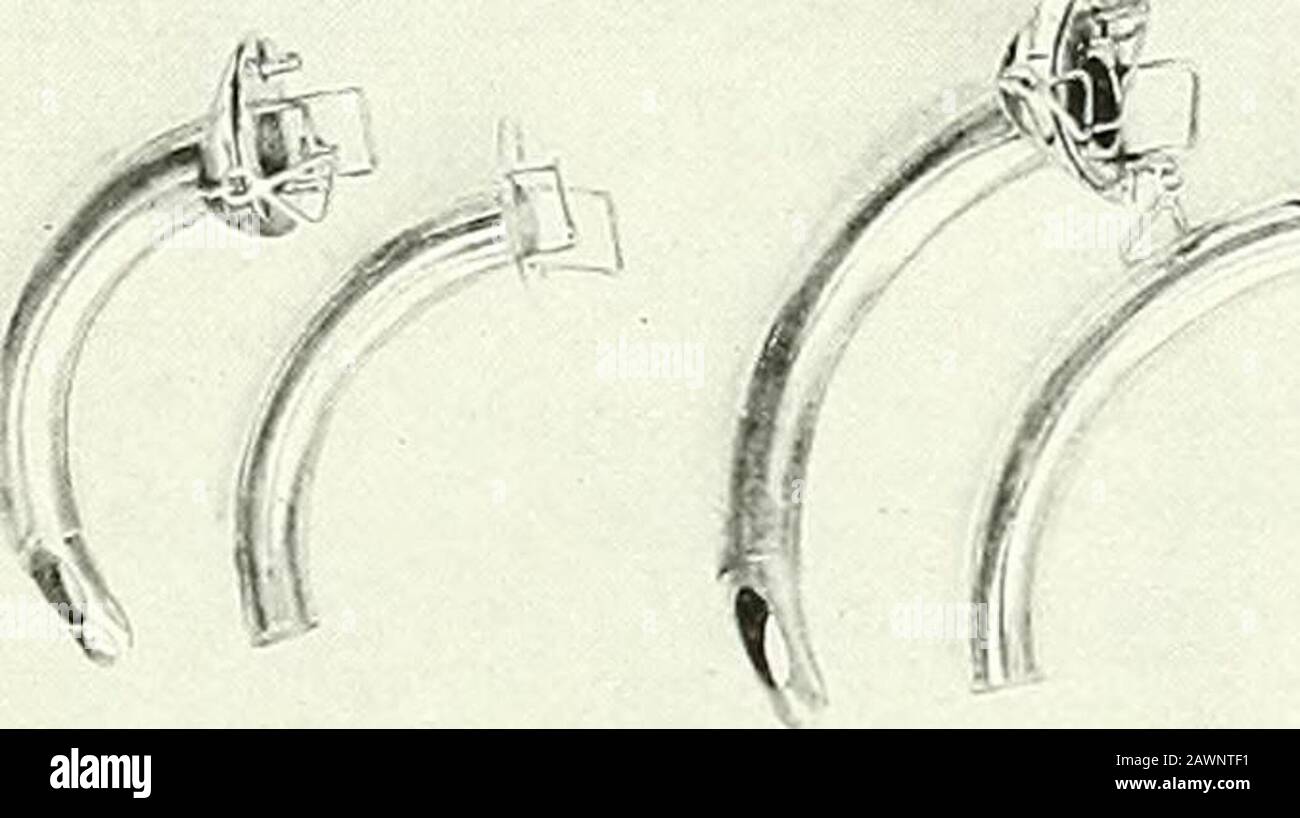 Operative technique hi-res stock photography and images - Alamy