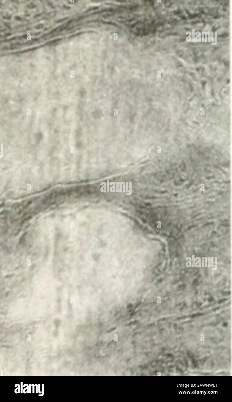 Sequestrum hi-res stock photography and images - Alamy