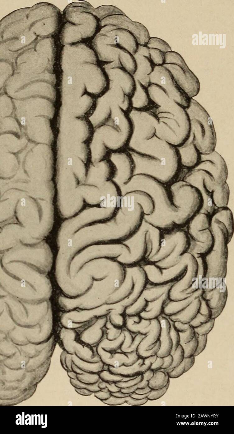 Nervous and mental diseases . 1. Fig. 337.—Brain of a blind hemiplegia ...