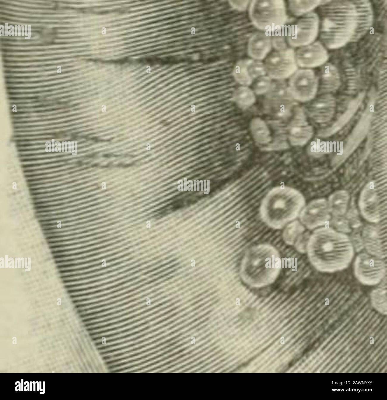 Handbook of meat inspection . Lipoma in adipose tissue of the aMo»ien ...